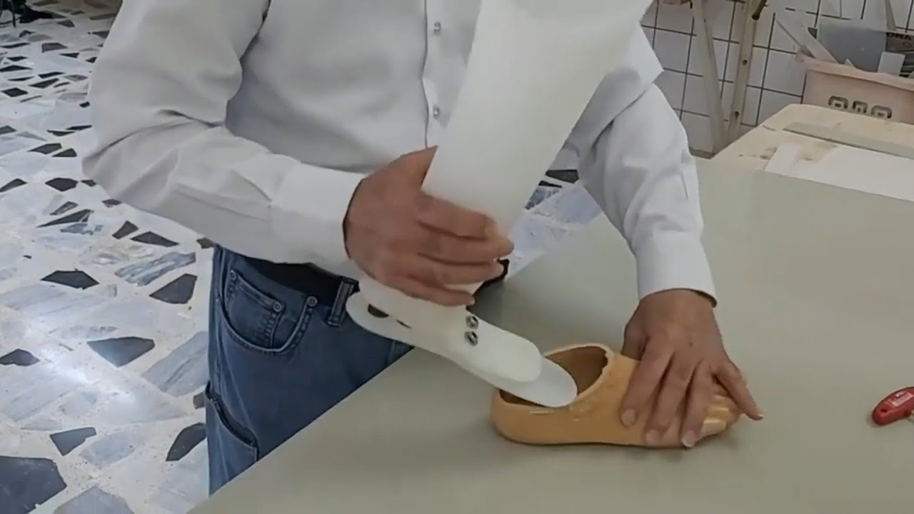this handmade foot is a revolution in the polypropylene prosthetic ...