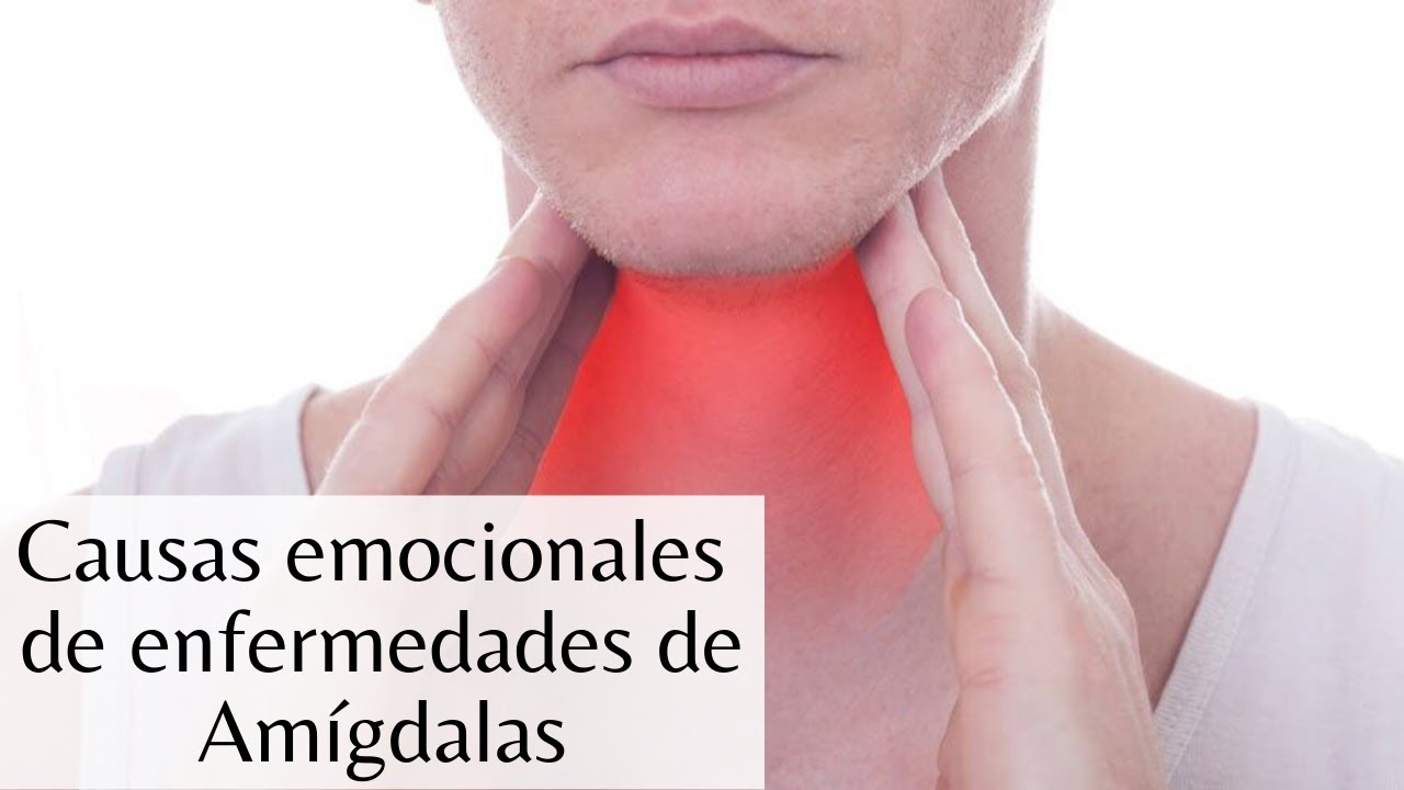 ¿Qué causa las enfermedades en las Amígdalas? - YouTube