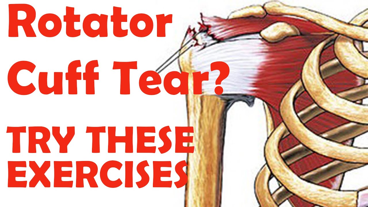 Exercises for Rotator Cuff Tear - YouTube