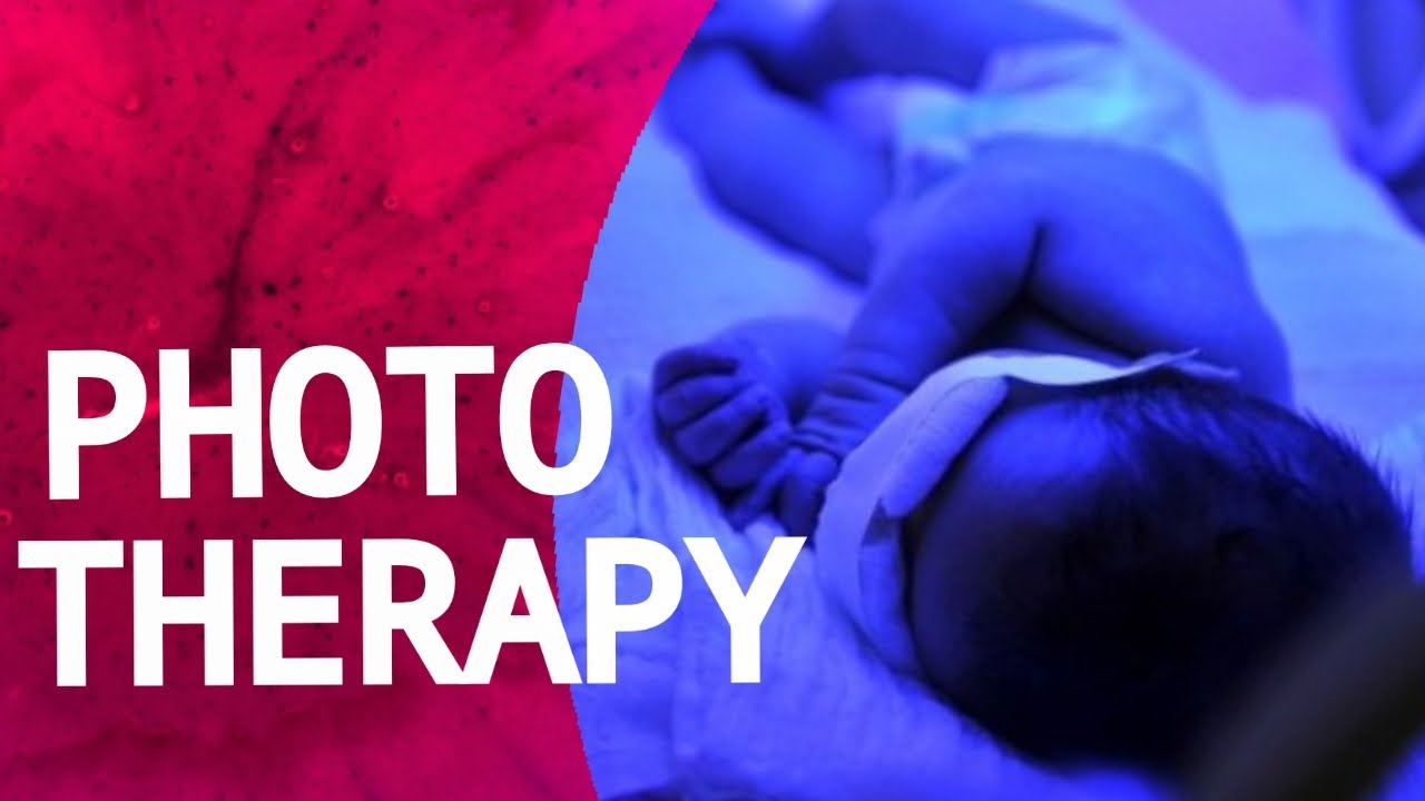 SOP Fototerapi pada Bayi - YouTube