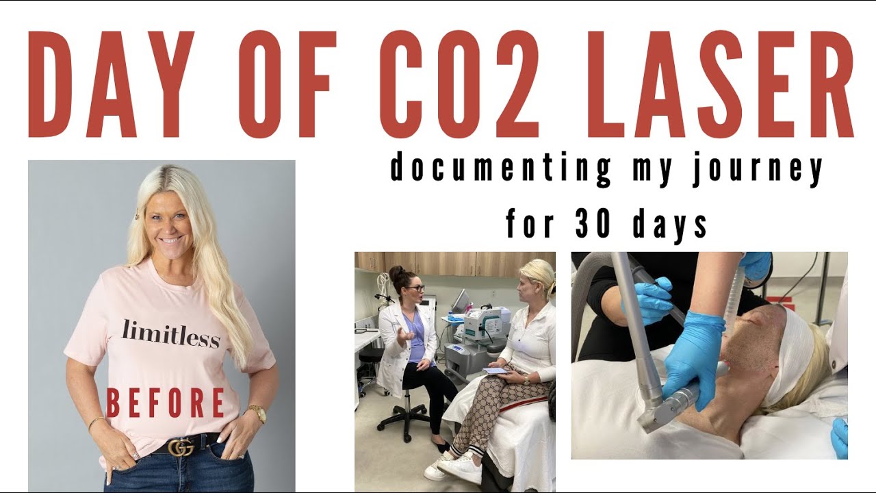 DAY of CO2 LASER RESURFACING- WHY? SERIES to show the DAILY "reality ...