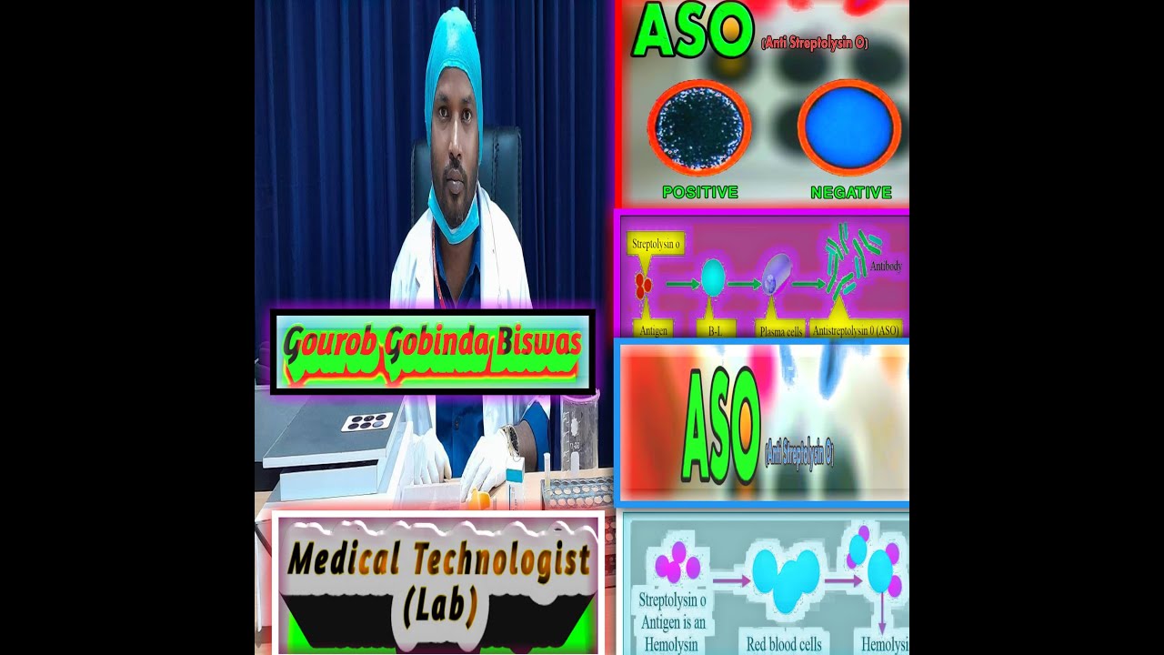 ASO Test . ASO Titre Test. High titre. Antistreptolysin o Test. - YouTube