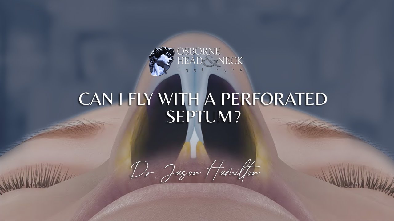 Can I Fly With A Perforated Septum YouTube can-i-fly-with-a-perforated-septum-youtube