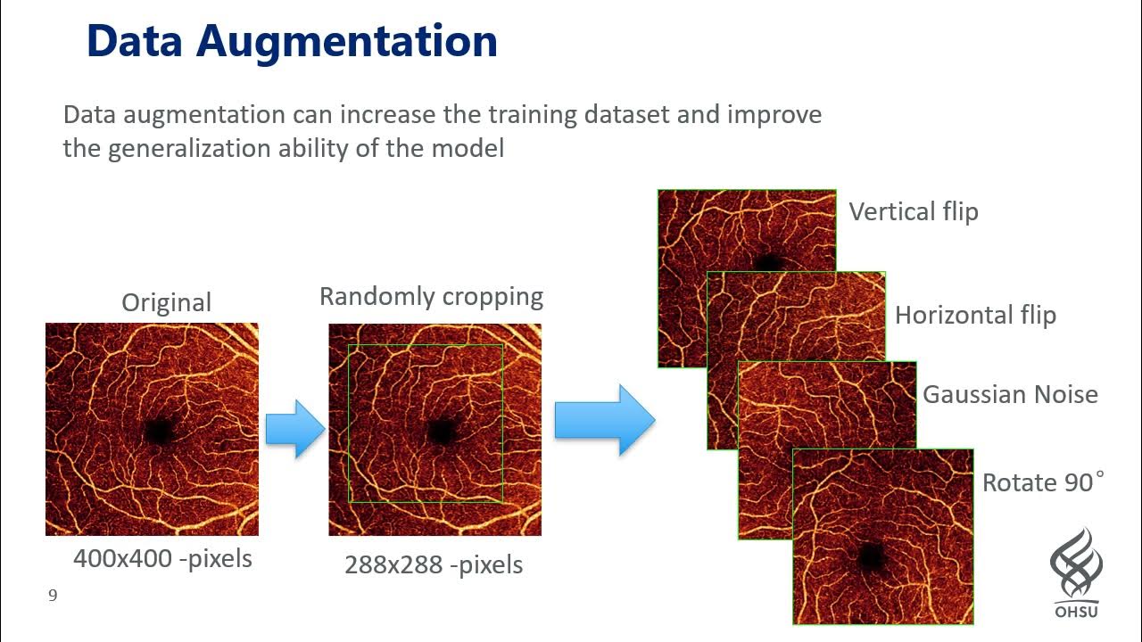 Nonperfusion area segmentation in three retinal plexuses on wide-field OCTA - YouTube