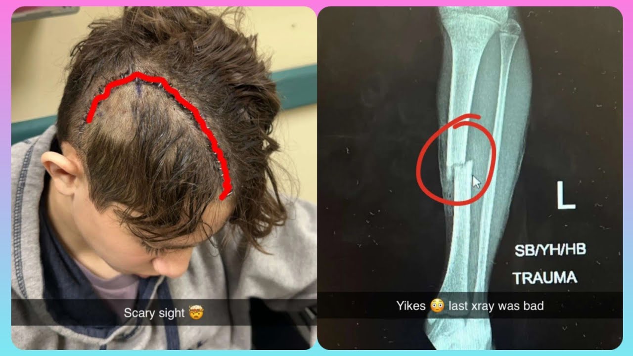 UPDATE: Nidal Wonder Health Progress and How he's healing - YouTube