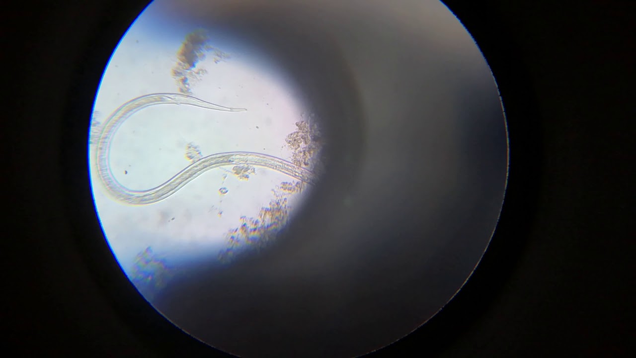 Activated sludge microbiology, 13/11/2018 - YouTube