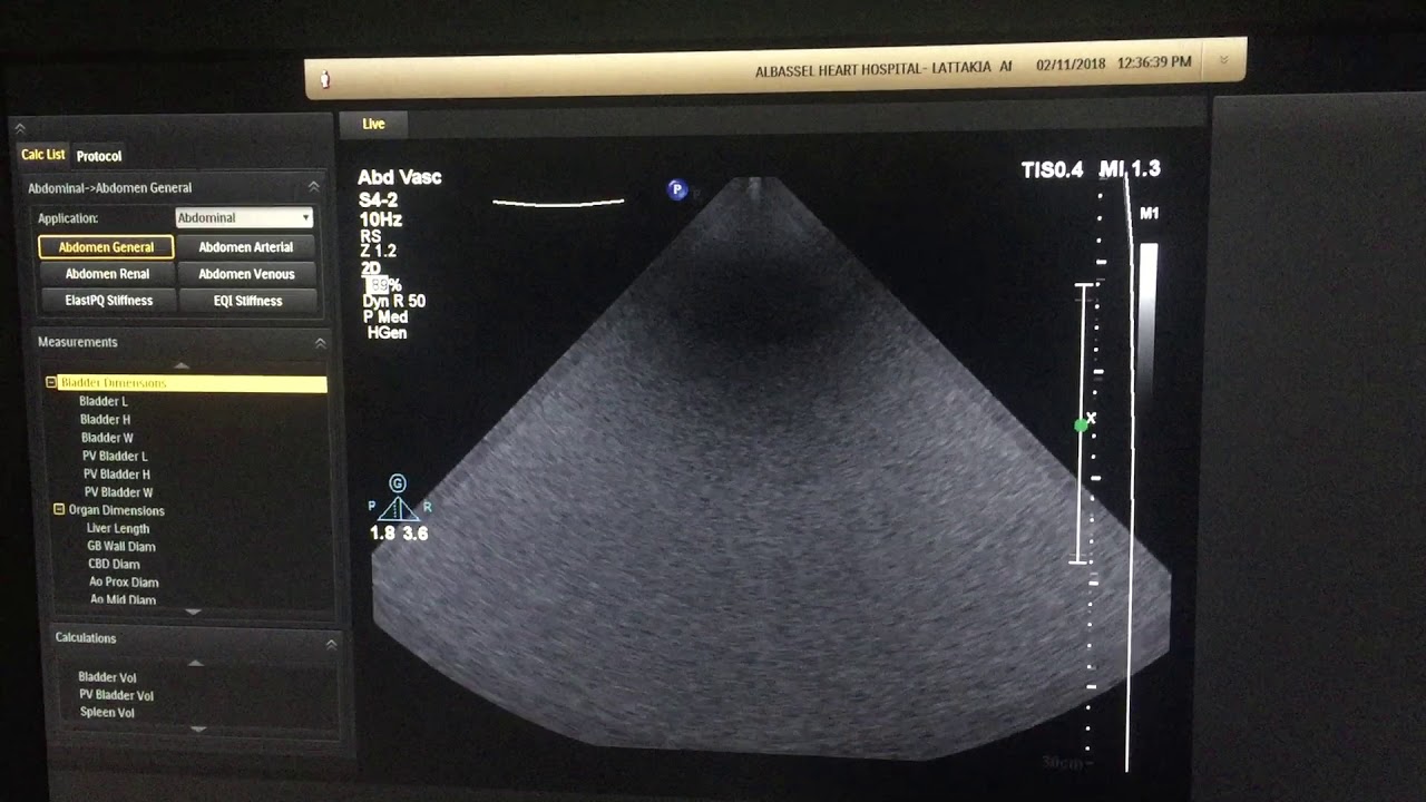 AFFINITI PART 3 - YouTube