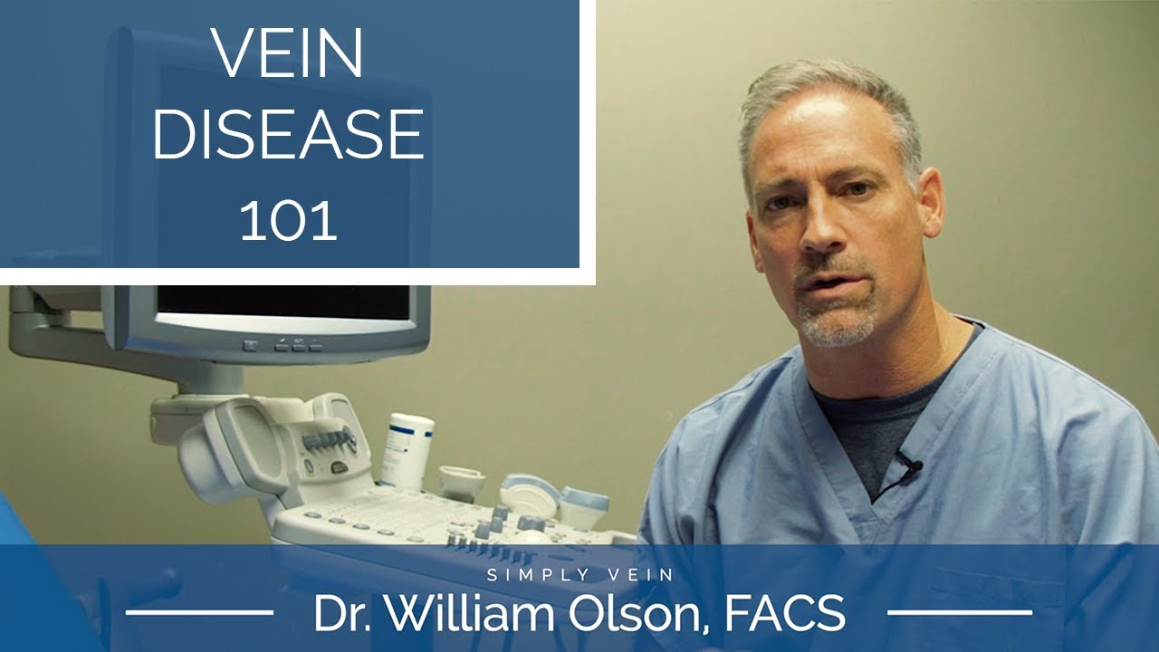 Vein Disease 101 | Dr. William Olson of Simply Vein - YouTube