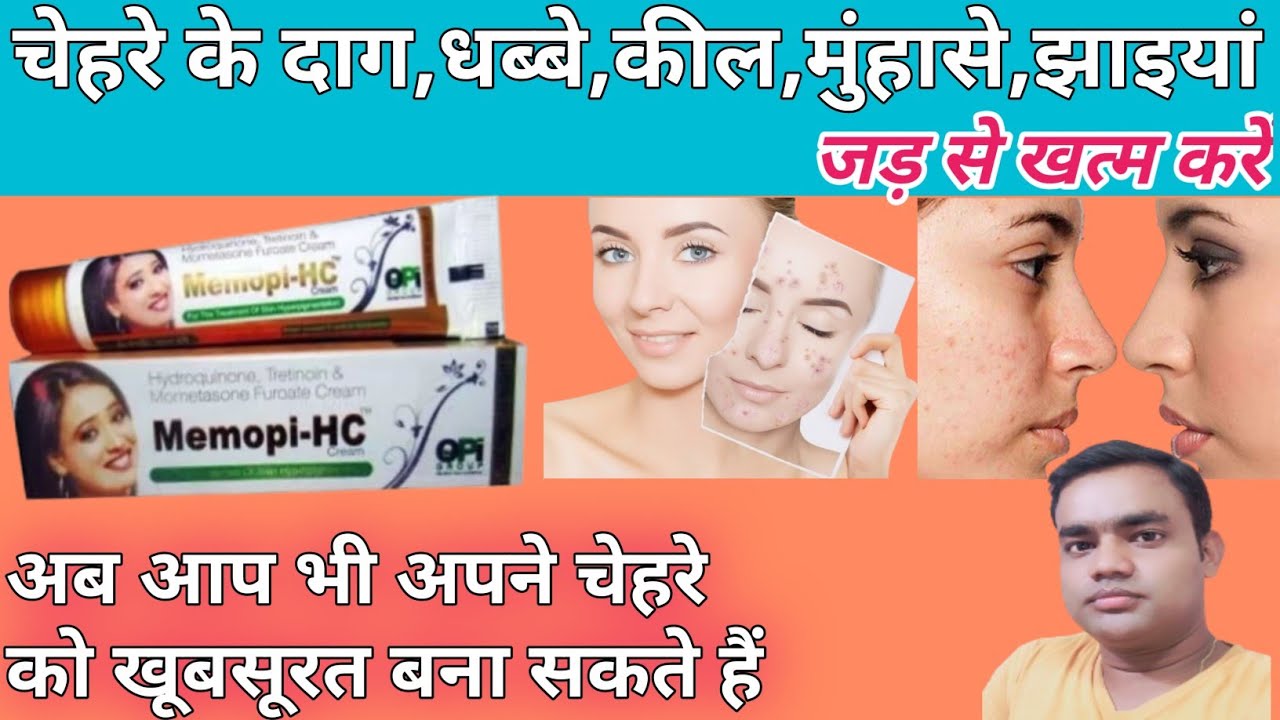 Memopi HC. चेहरे के दाग,धब्बे,कील,मुंहासे,झाइयां को जड़ से ठीक करता है ...