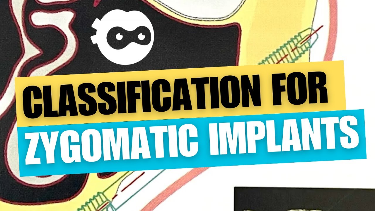 Classification for Zygomatic implants - YouTube