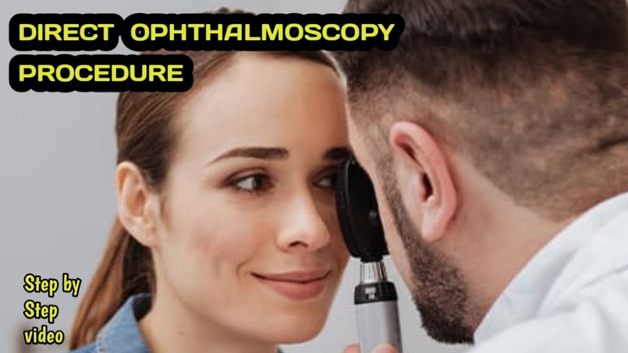 Procedure of direct ophthalmoscopy explained indetail @eyecareoptom # ...