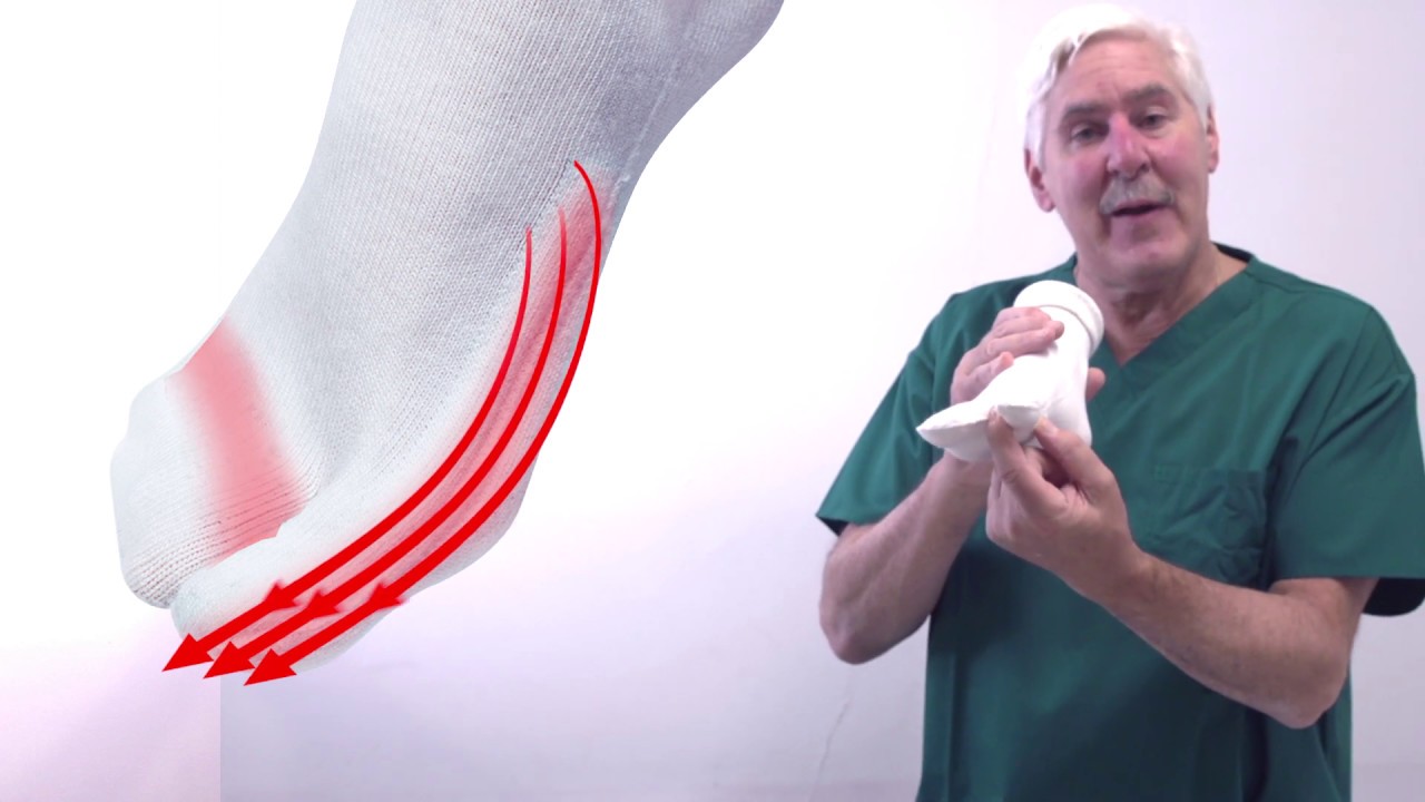 Sockdocs® - Bunion Buster™ - YouTube