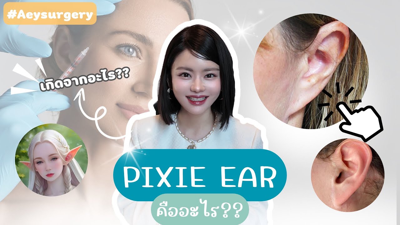 ภาวะ Pixie Ear คืออะไร? ดึงหน้าแล้วหูยานน - YouTube