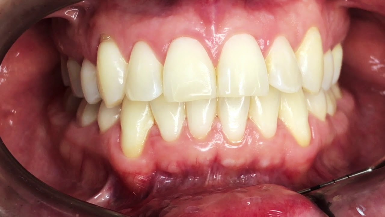 Anatomía Periodontal - YouTube
