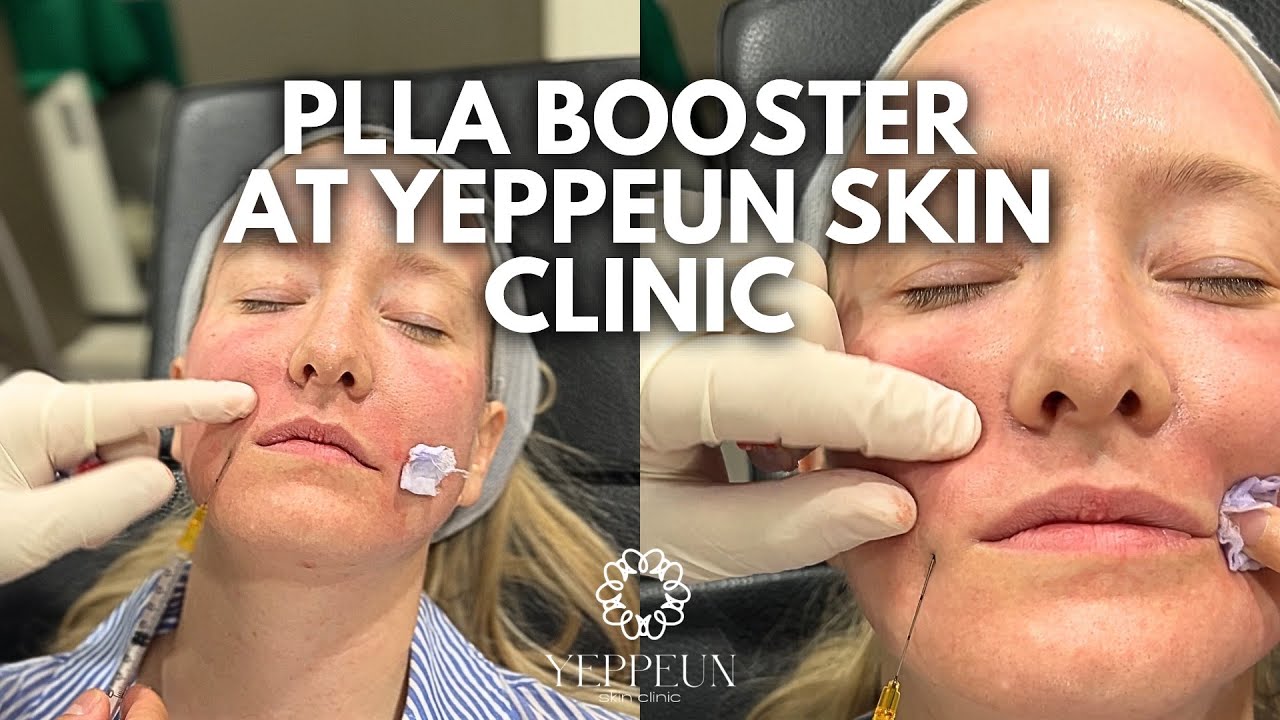PLLA Booster at Yeppeun Skin Clinic: The Secret to Youthful, Radiant ...