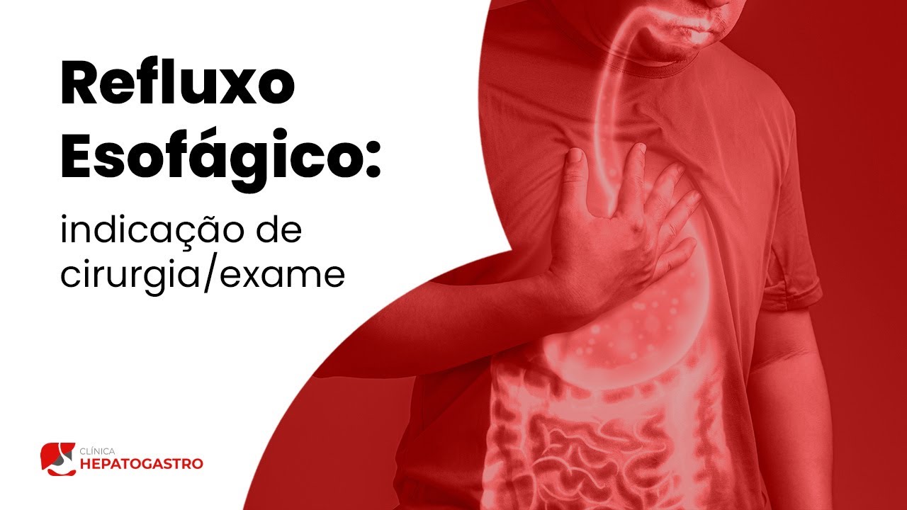 Refluxo Esofágico: indicação de cirurgia/exame | Clínica Hepatogastro ...