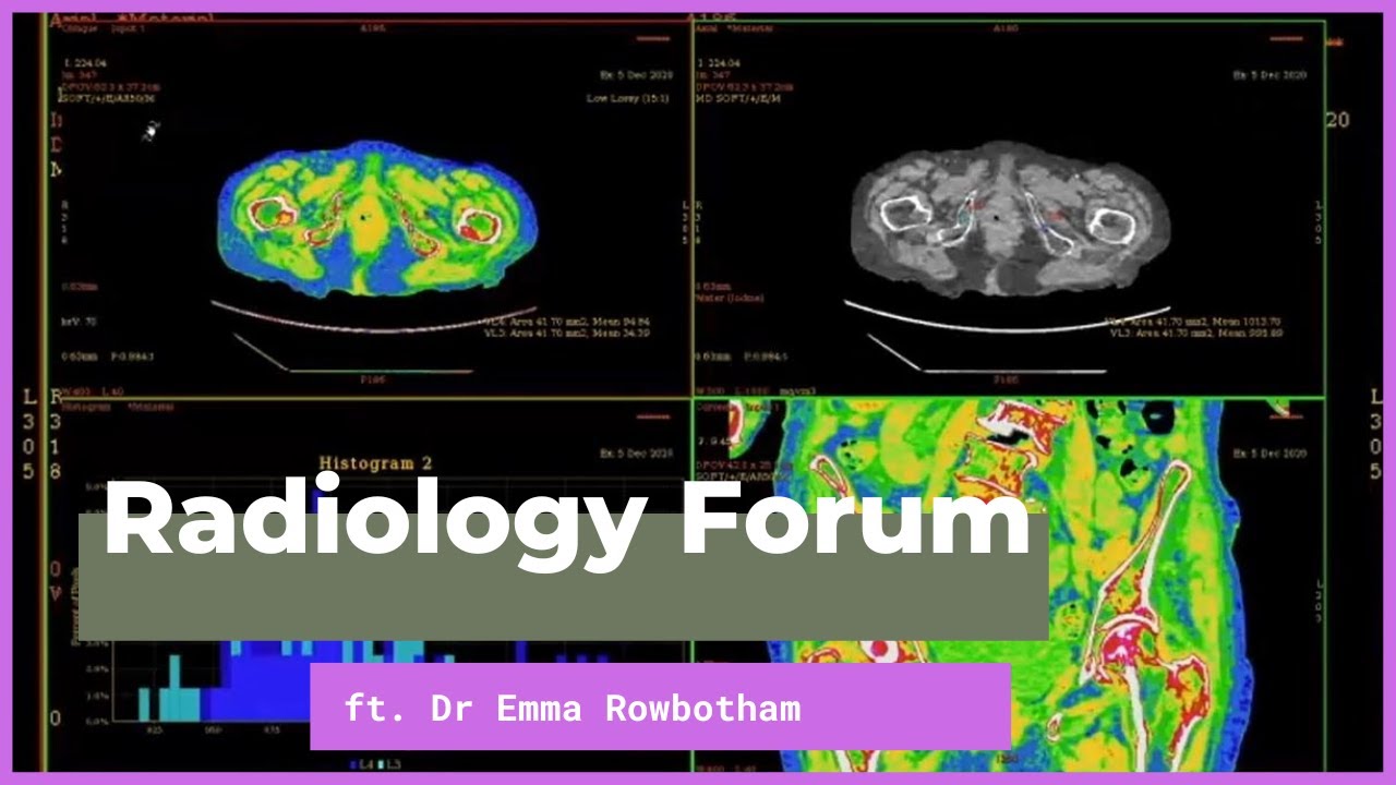 'Dual Energy CT in MSK Imaging: Help or Hindrance?’ by Dr Emma ...