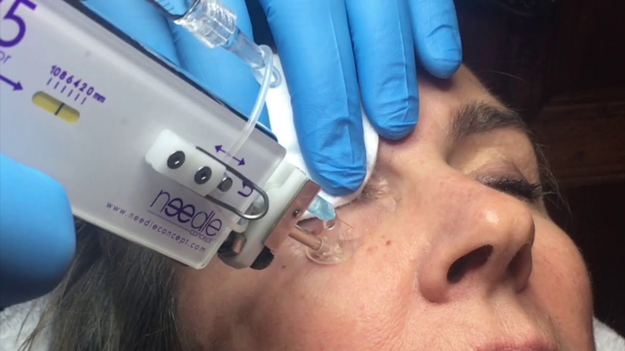 RRS HA Eyes application with U225 - YouTube