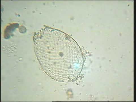 Euglypha sp ameba testacea 3 x40 Guadarrama azu Antonio - YouTube