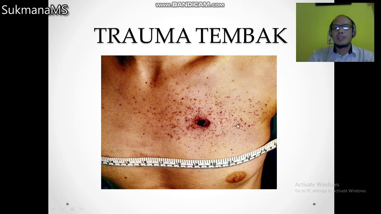 Video Pendahuluan Trauma Dada - YouTube
