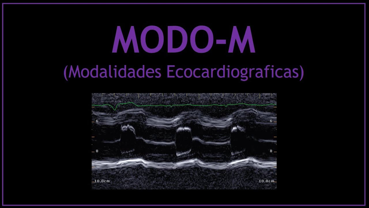 MODO-M (Modalidades Ecocardiograficas)! - YouTube