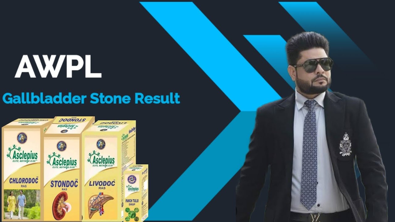 Gallbladder Stone Result AWPL | AWPL Product Result | Stonedoc ...