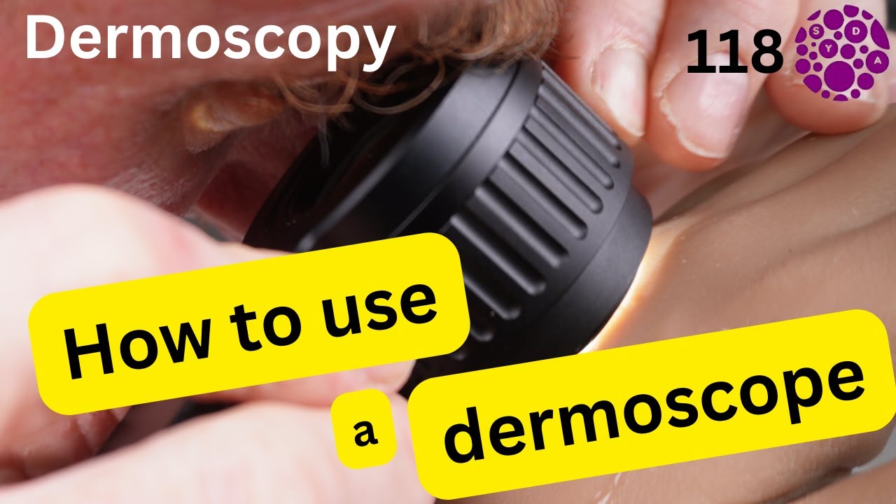 How to use a Hybrid Dermoscope and 10 top reasons people fail - YouTube