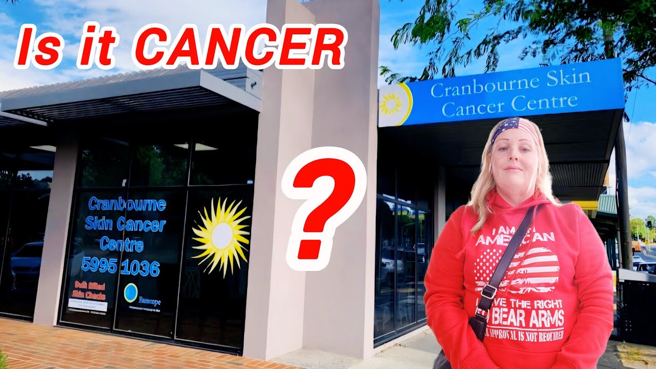 Can I Conquer Skin Cancer by Getting a Skin Check? #HGW - YouTube