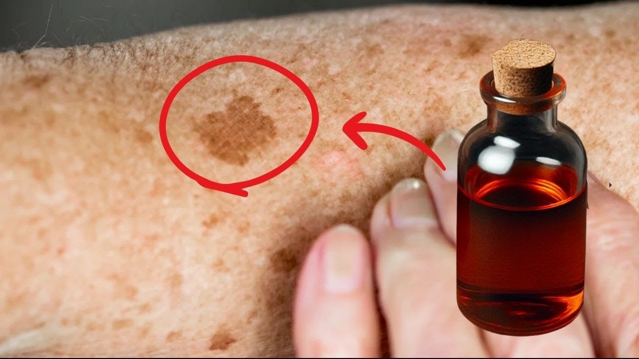 APPLY Just 1 DROP... Your AGE SPOTS Will Be ERASED FOREVER - YouTube