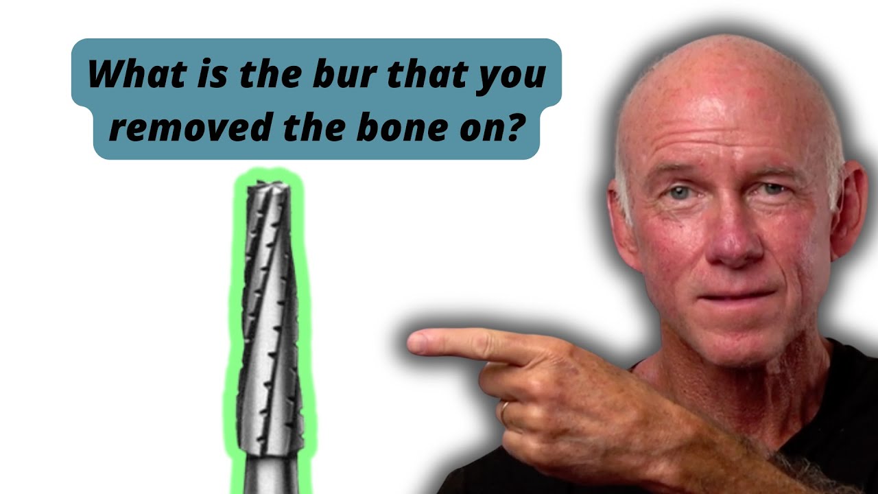 What is the bur that you removed the bone on? - YouTube