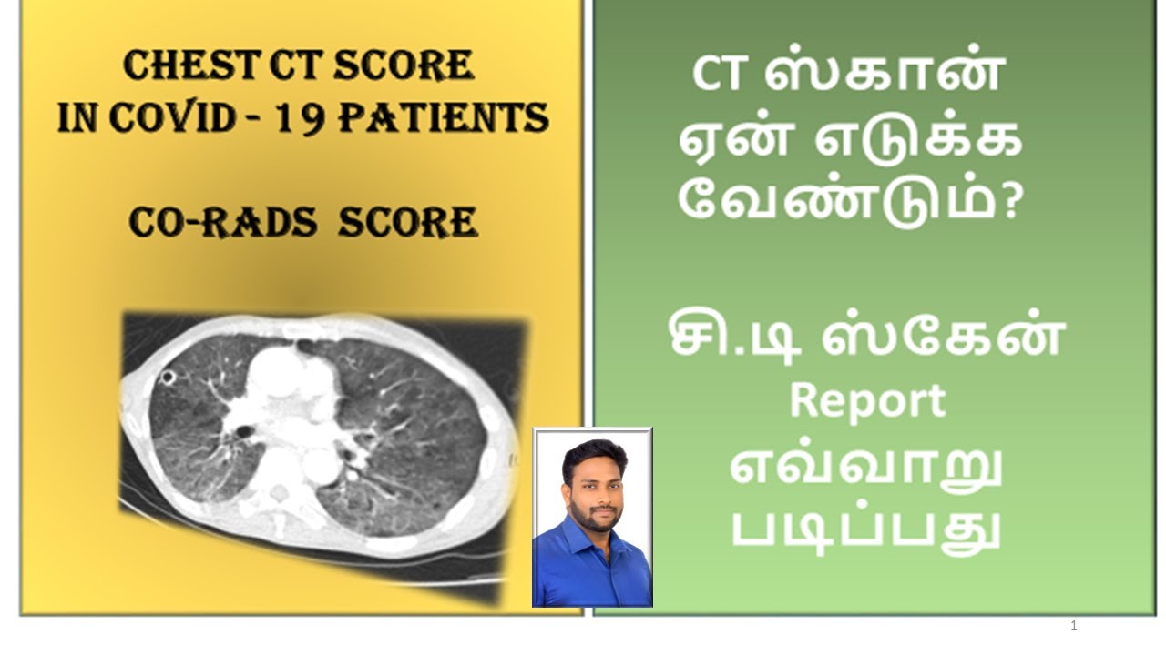 How To Read CT Scan Report Of COVID 19 Patients What Is CO RADS Score How To Read CT Scan Report Of COVID 19 Patients What Is CO RADS Score