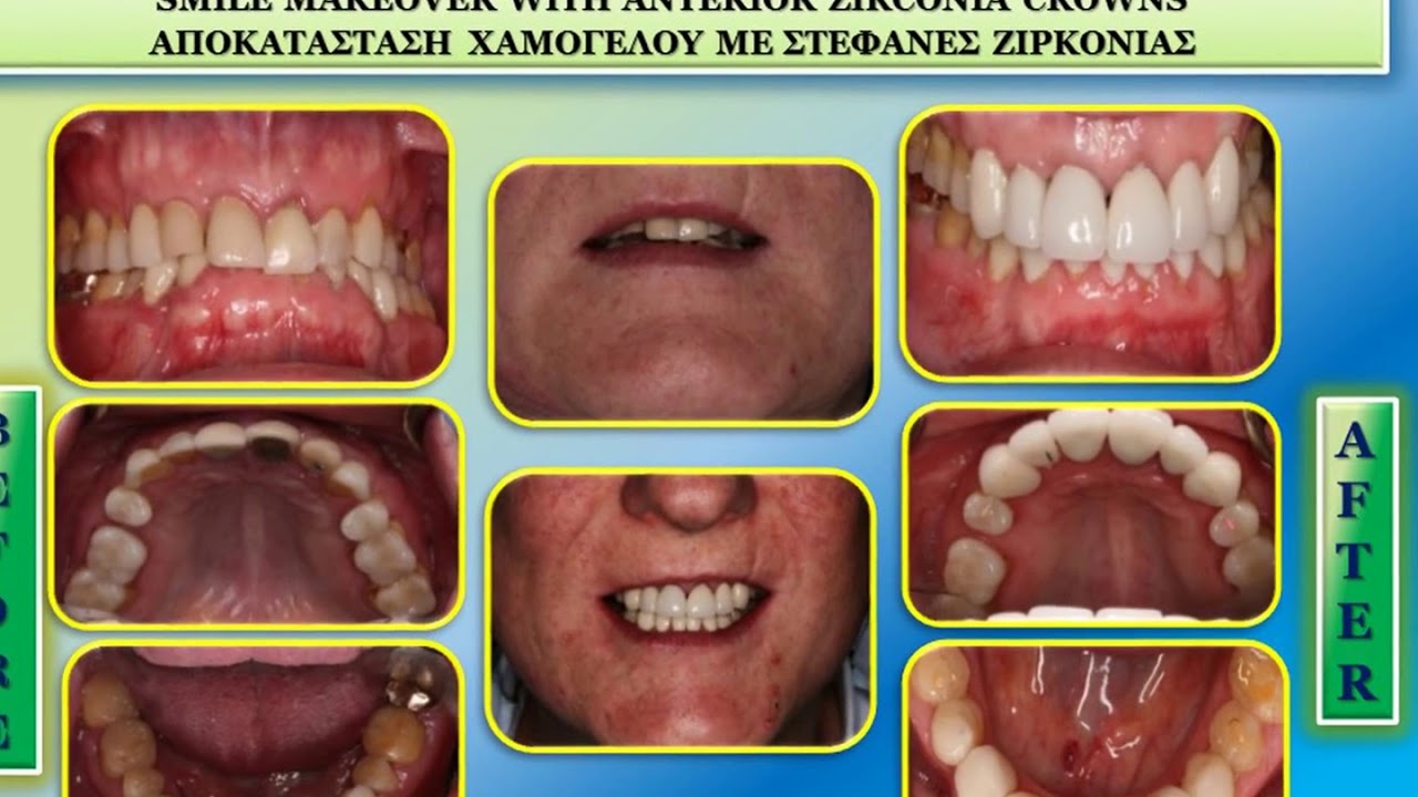 Αντίγραφο του βίντεο Paphos Smile Art Studio Paphos Dental Clinic ...