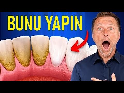 Diş Plağı (Tartar) İçin 1 Numaralı En Etkili Doğal Çözüm! | Dr. Berg Türkçe