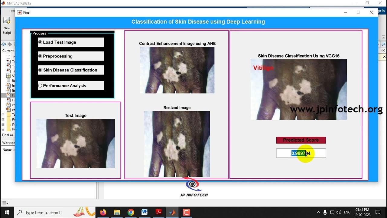 Skin Disease Classification using Deep Learning | MATLAB | Final Year IEEE Project - YouTube
