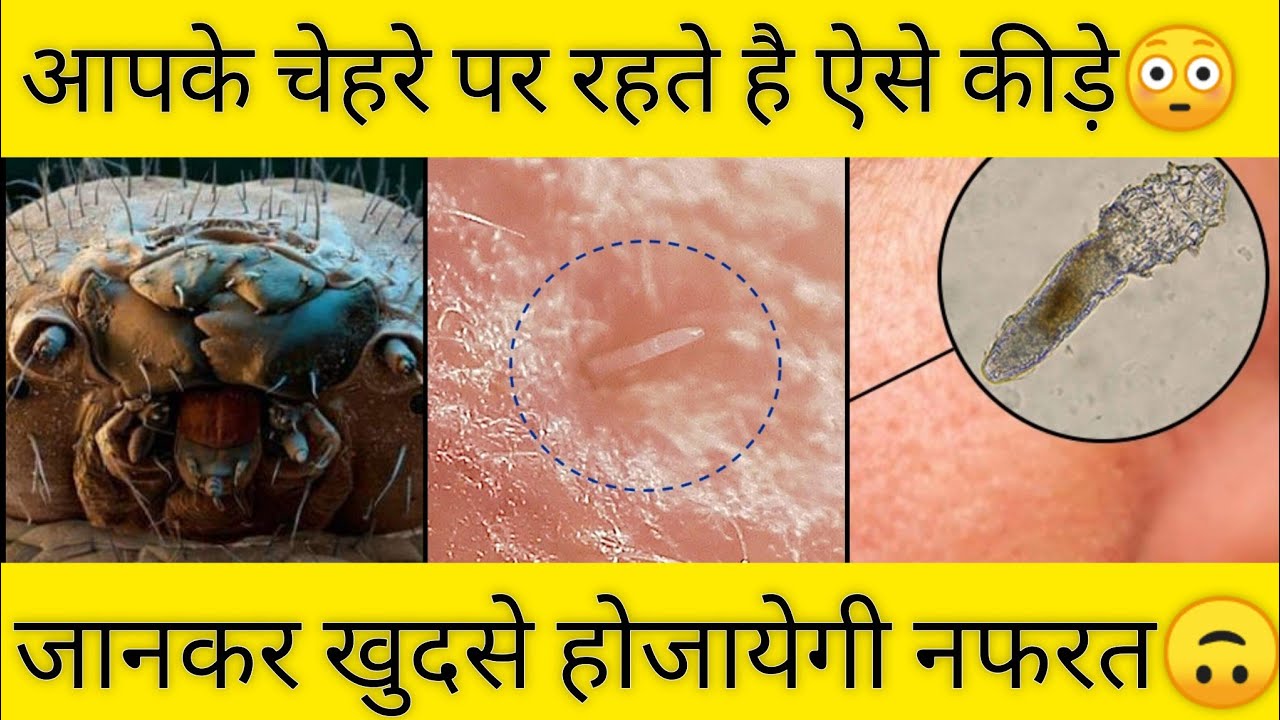 आपके चेहरे पर रहते है ऐसे कीड़े😳.||Such Insects Live On Your Face 🙃 # ...