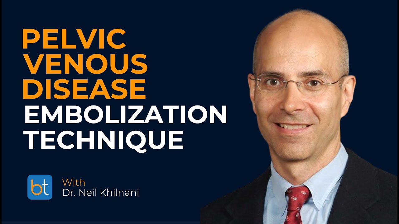 What is your embolization technique for the ovarian vein? #embolization ...