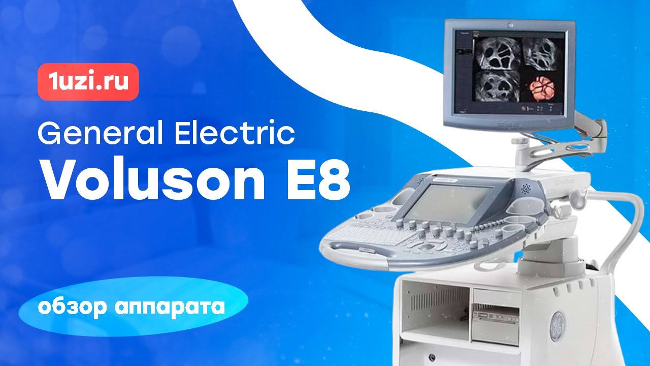 Обзор УЗИ аппарата GE VOLUSON E8 - YouTube