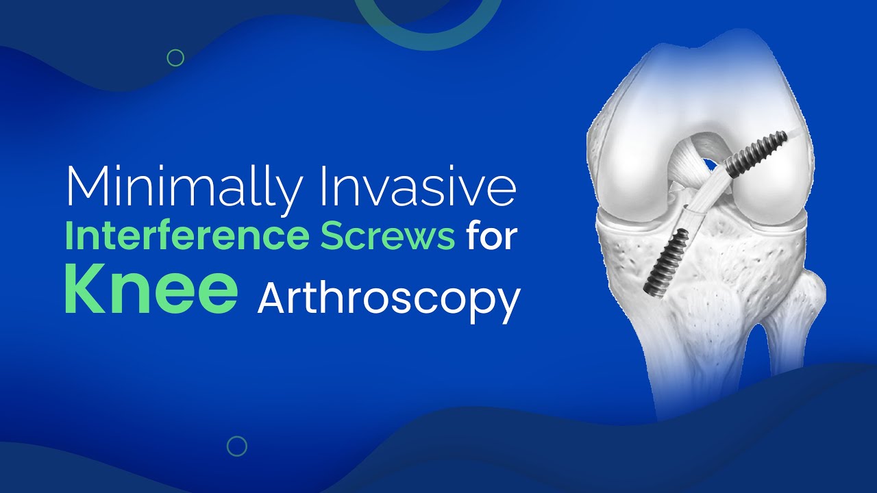Knee Arthroscopy: Minimally Invasive Interference Screw - YouTube