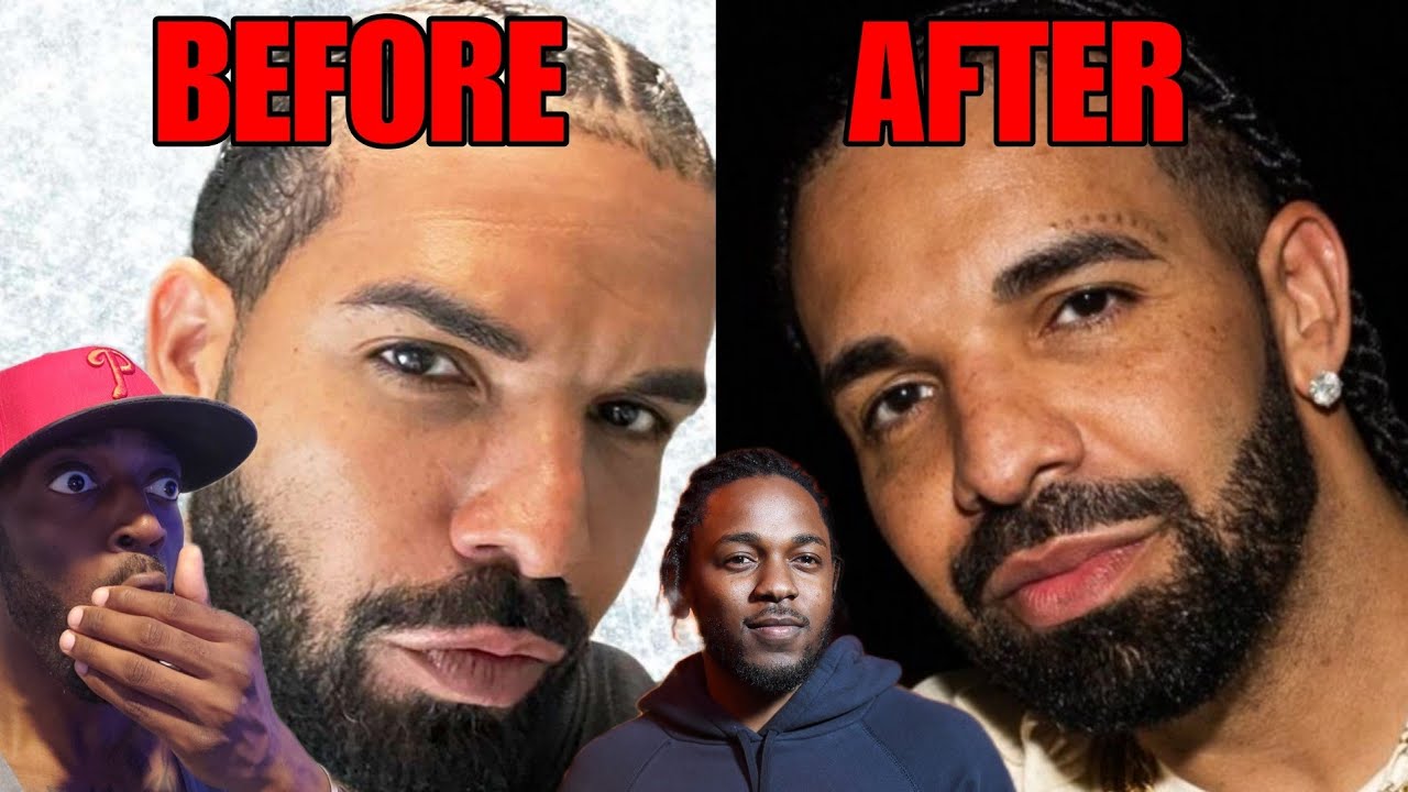 Drake Finally Responds To "Not Like Us" Looking Defended & Stressed ...