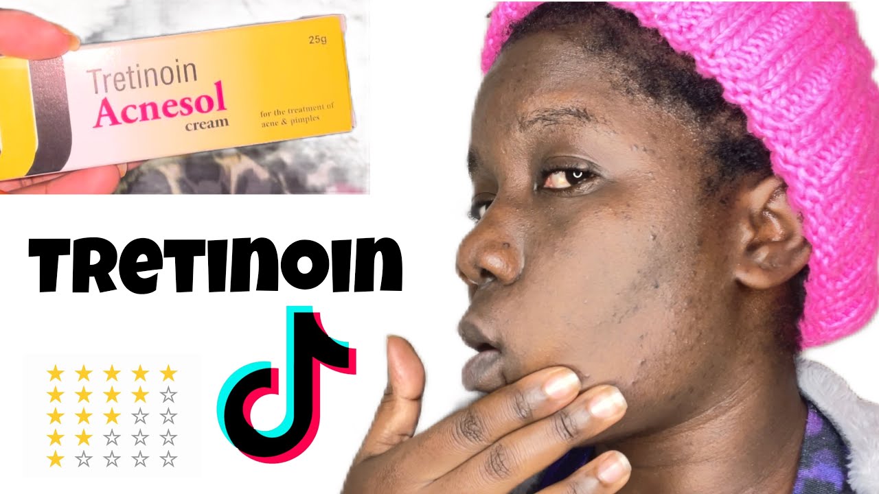 TikTok viral Tretinoin/acnesol for hyperpigmentation/dark spot/acne and ...