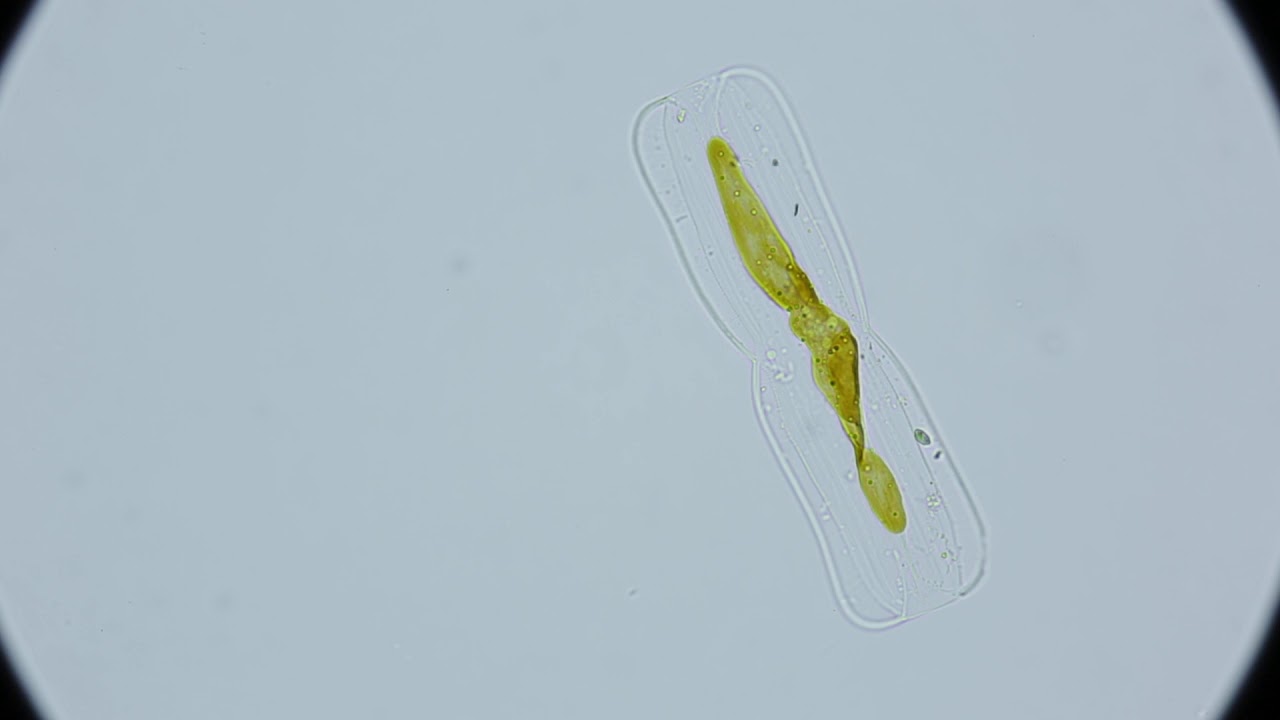 Antarctic Entomoneis Diatom (80x) from McMurdo Sound near Erebus Ice ...