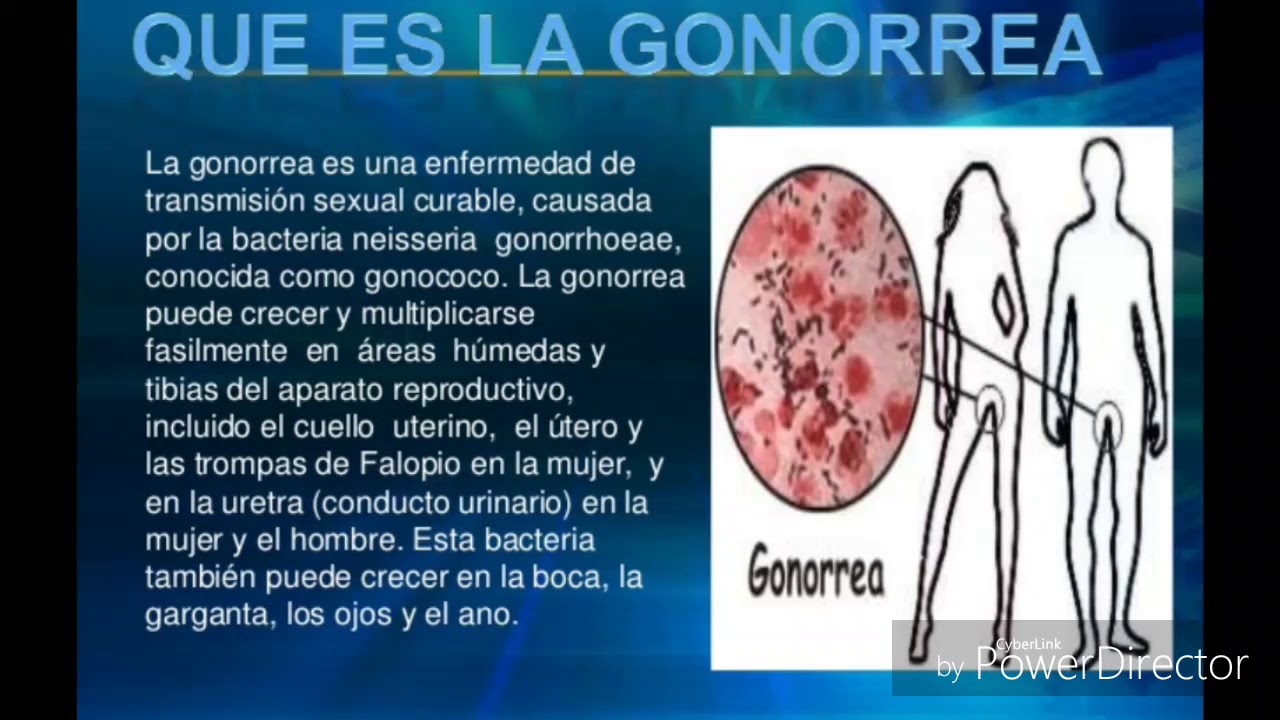 LA GORRONEA - YouTube