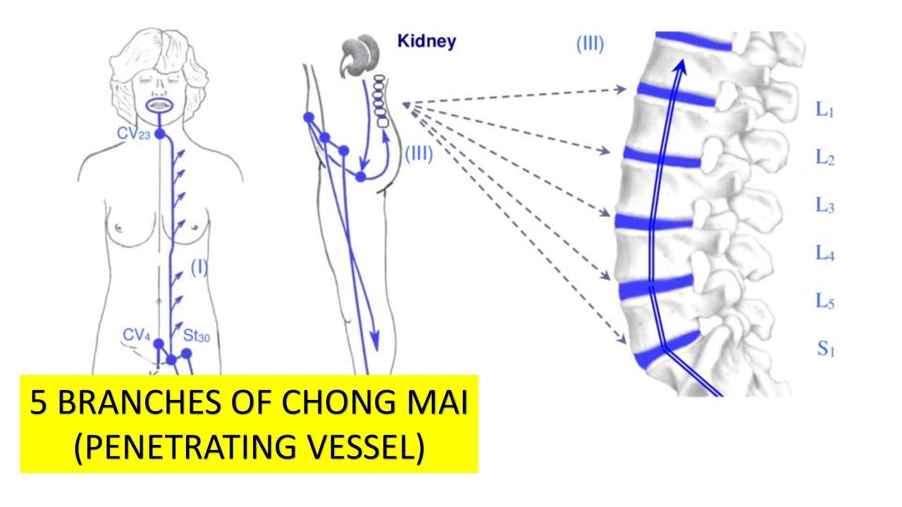 CHONG MAI (PENETRATING VESSEL) FIVE BRANCHES CLINICAL SIGNIFICANCE ...