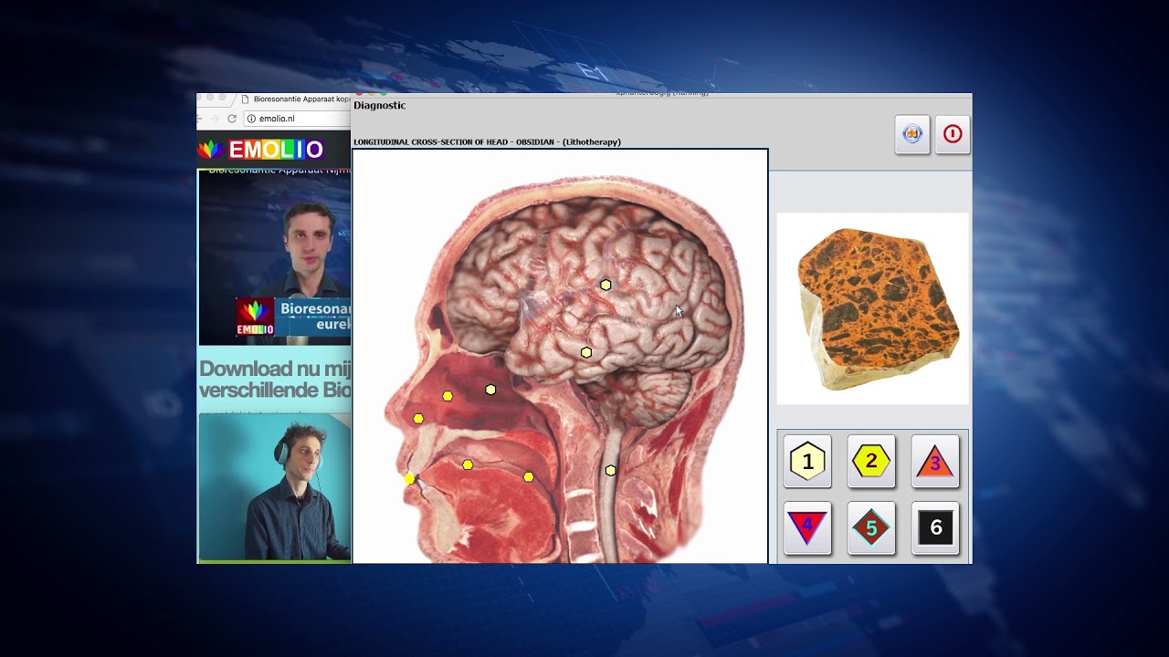 Quantum Hunter Bioresonantie Apparaat Introductie - YouTube