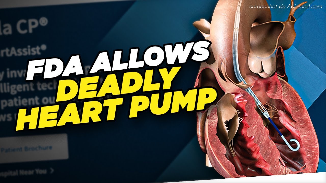 Medical Device Used In Heart Surgery Now Linked To Multiple Deaths ...