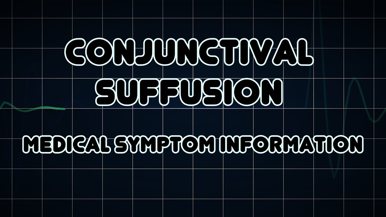 Conjunctival suffusion (Medical Symptom) - YouTube