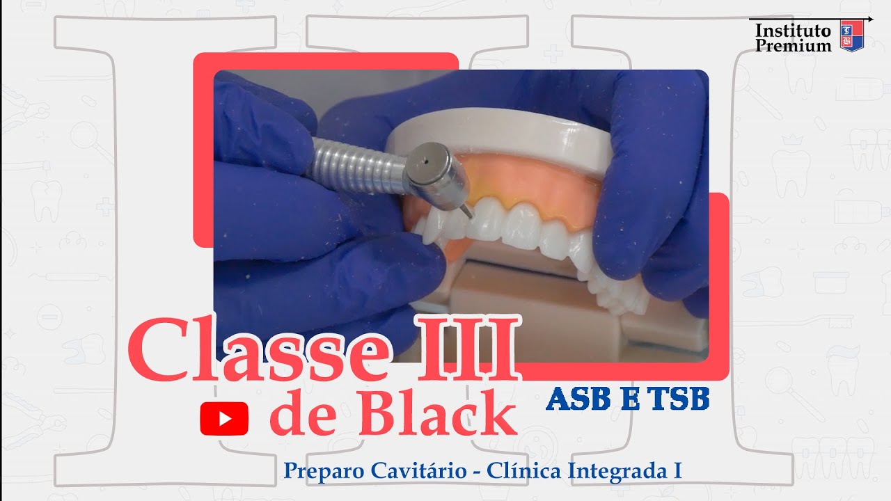 PREPARO CAVITÁRIO #3 - Instituto Premium 🦷 - YouTube