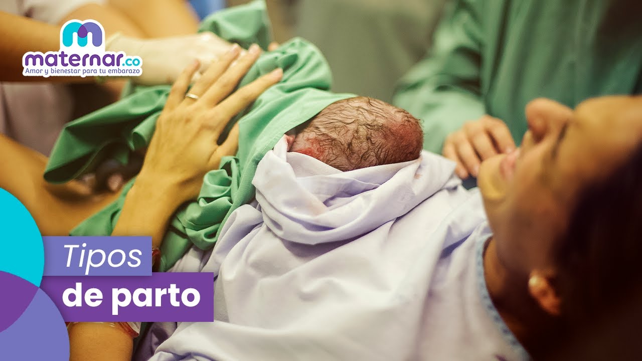 Tipos de parto: ¿Cómo prepararte para el nacimiento de tu bebé ...