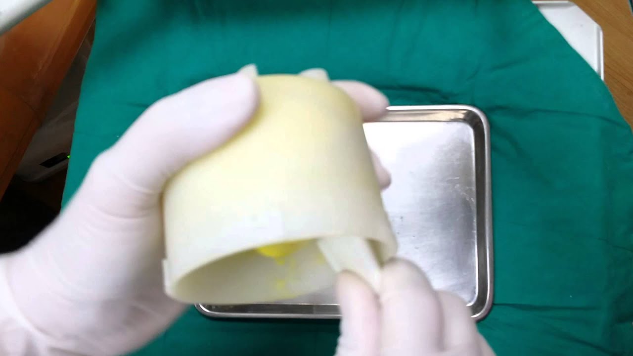 Alginate load on tray using alginate mixer - YouTube