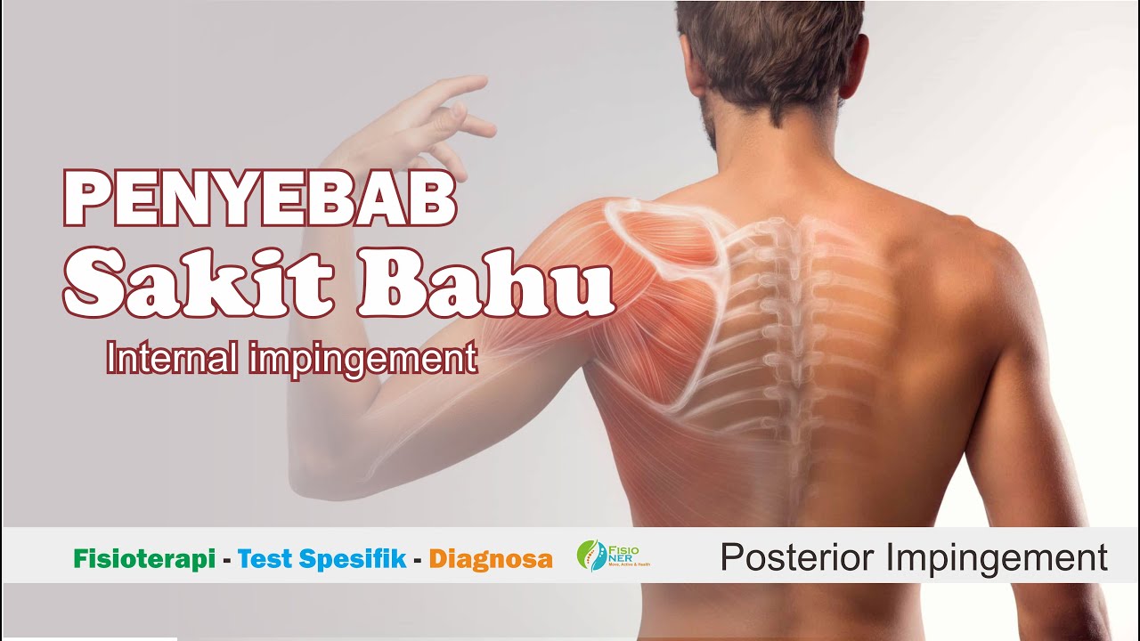 Pemeriksaan Bahu - Posterior Impingement Sign - Peradangan Otot ...